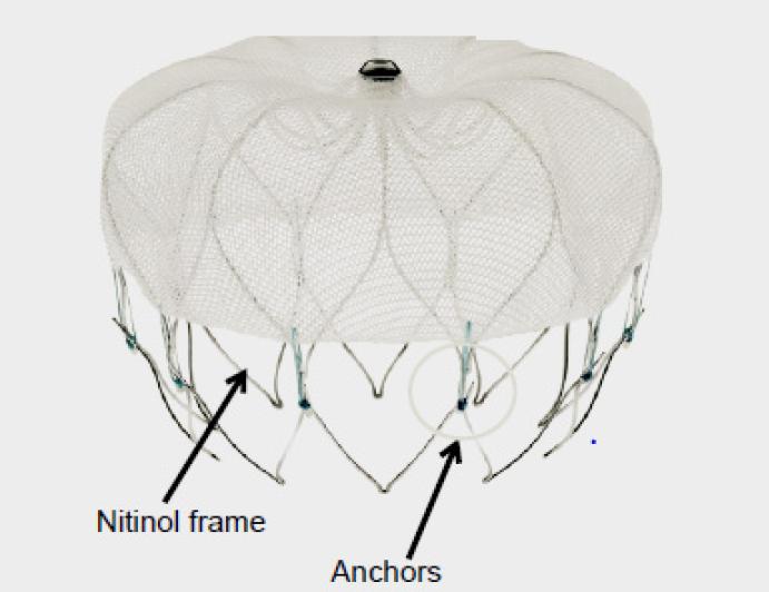 Left atrial appendage Closure Overview & Case Examples | tctmd.com